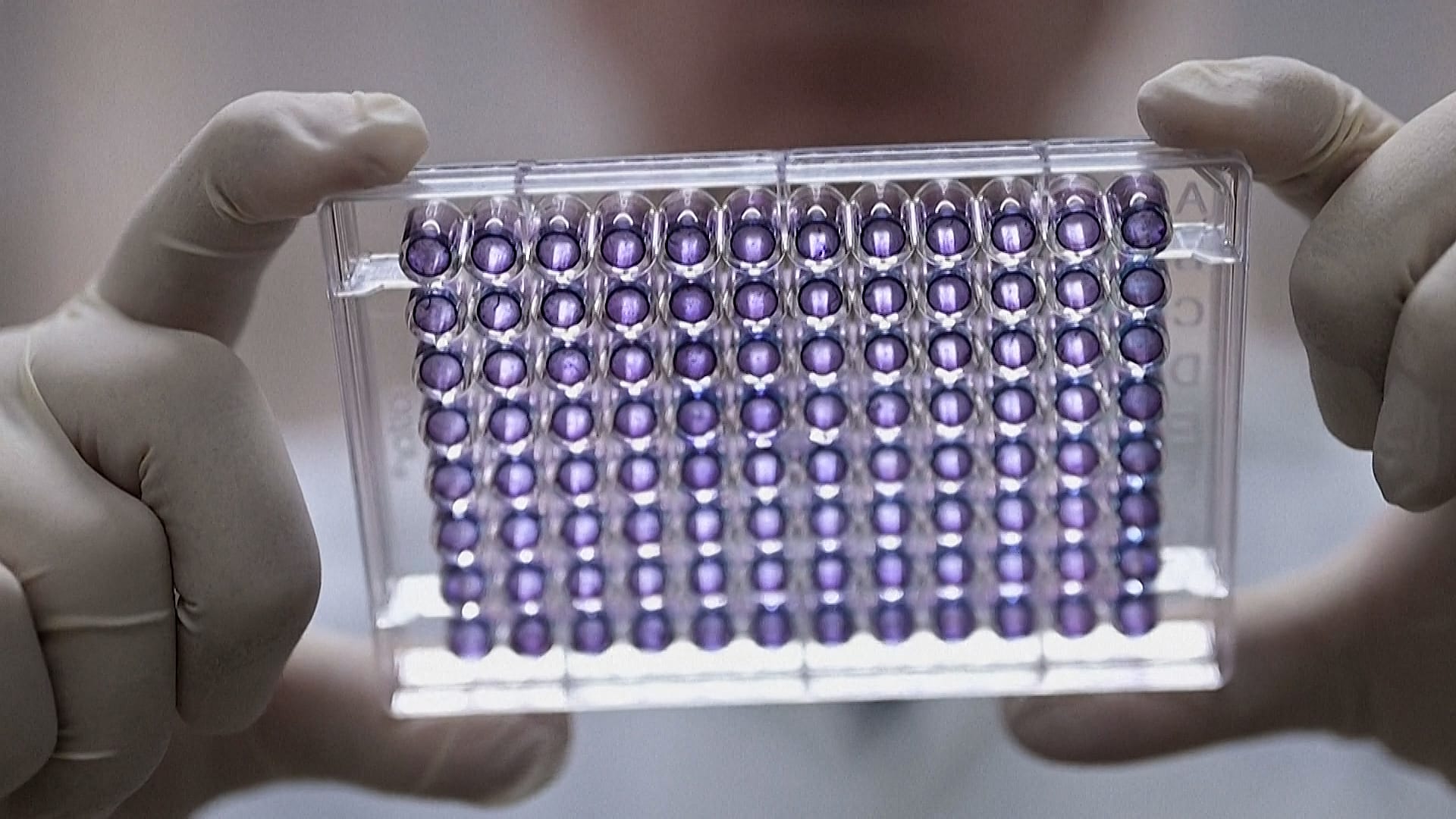 Scientists in Brazil are developing the first vaccine that could help ...