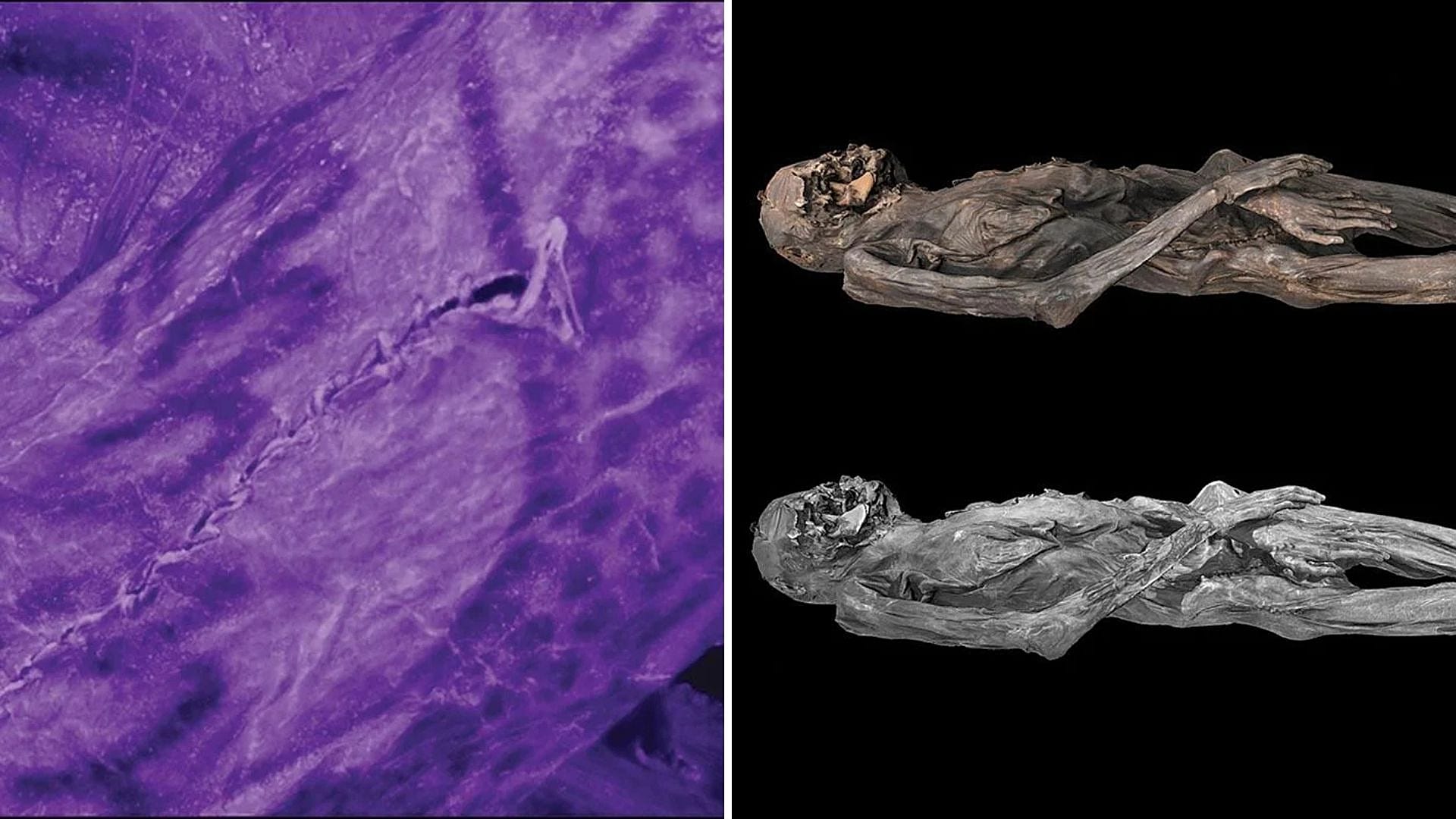 Extraordinary ancient tattoo art uncovered on 2300-year-old ice mummy ...