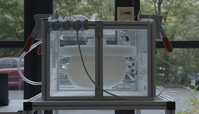 Video. This ‘artificial womb’ could save the lives of very premature ...