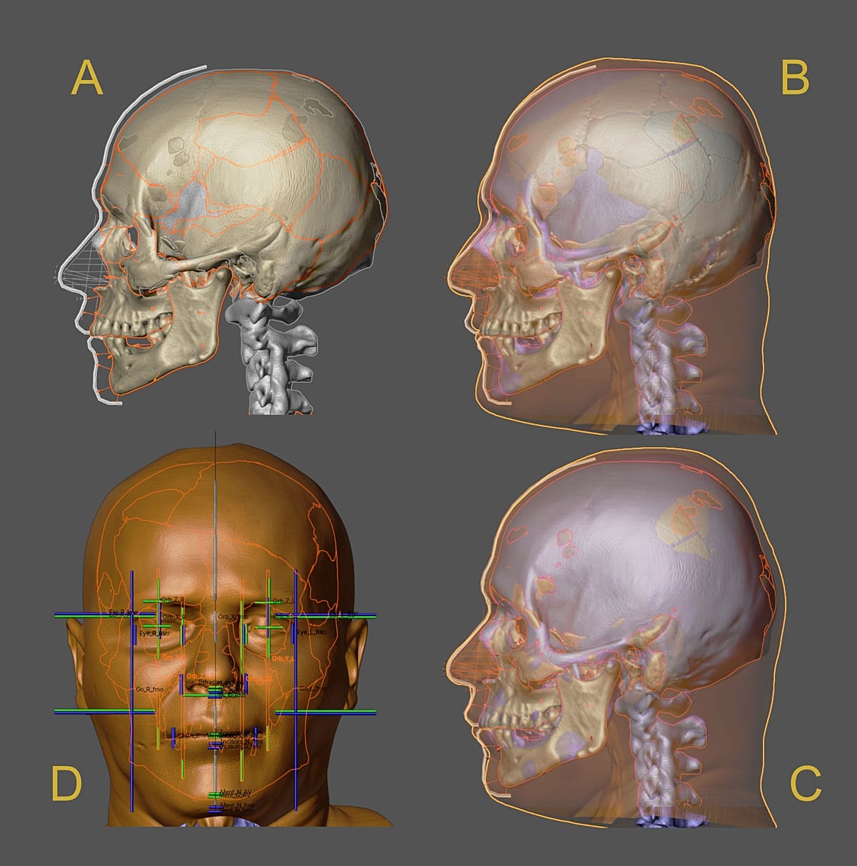 From beyond the grave: Archaeologists bring 'vampire' back to life ...